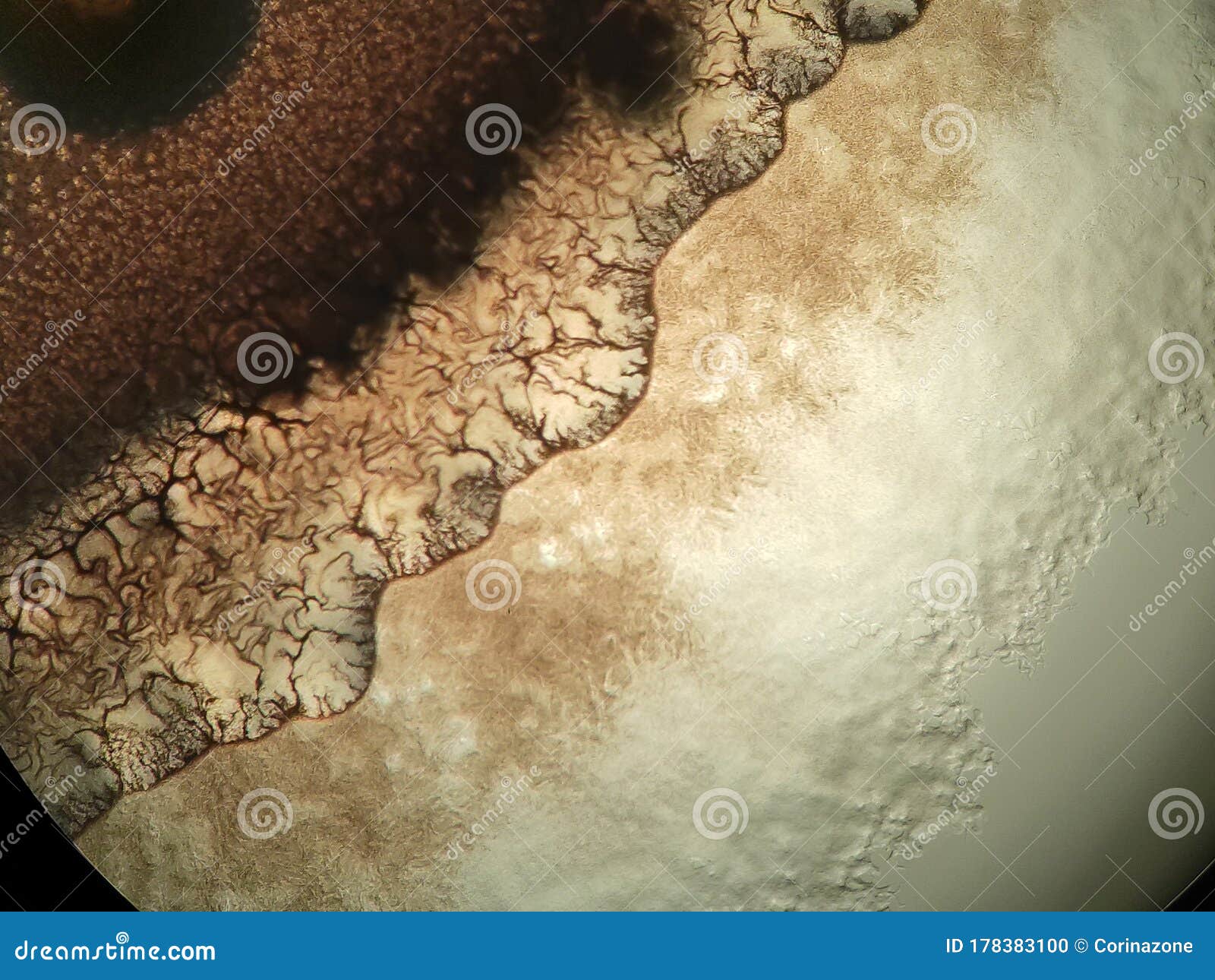 The Art of Bacteria Microscope View of Bacillus and Other Bacteria ...