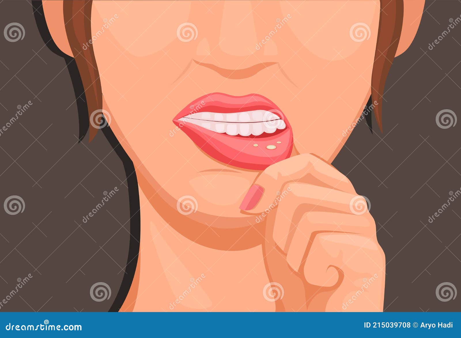 Women Touch Lips Sprue, Symptoms of Stomatitis. Health Medical Symbol ...