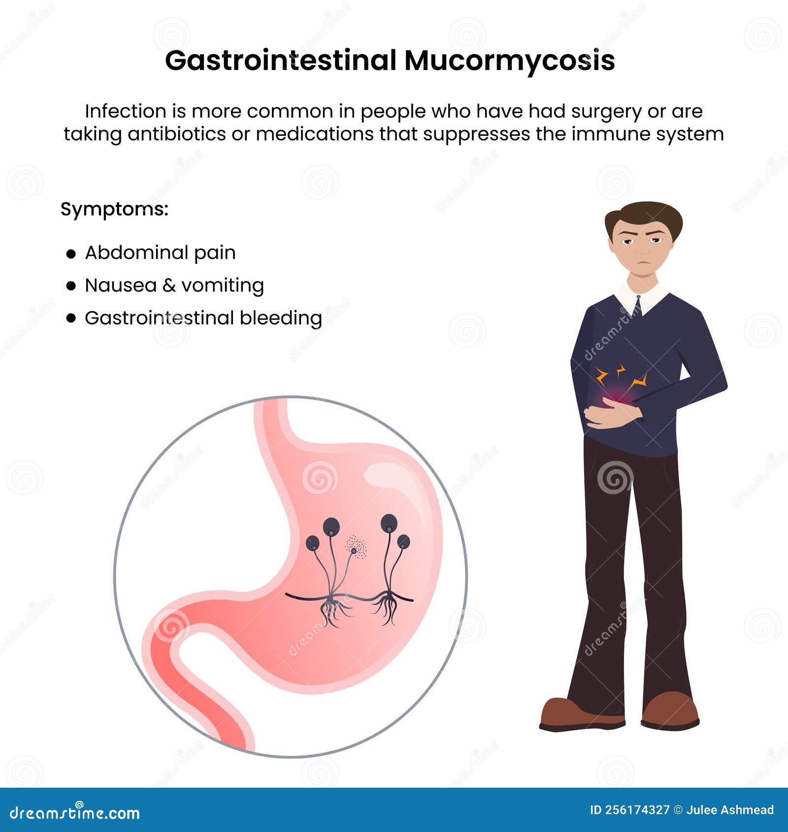 Risk Of Complications, Severe Bleeding Neon Glow Icon Illustration ...