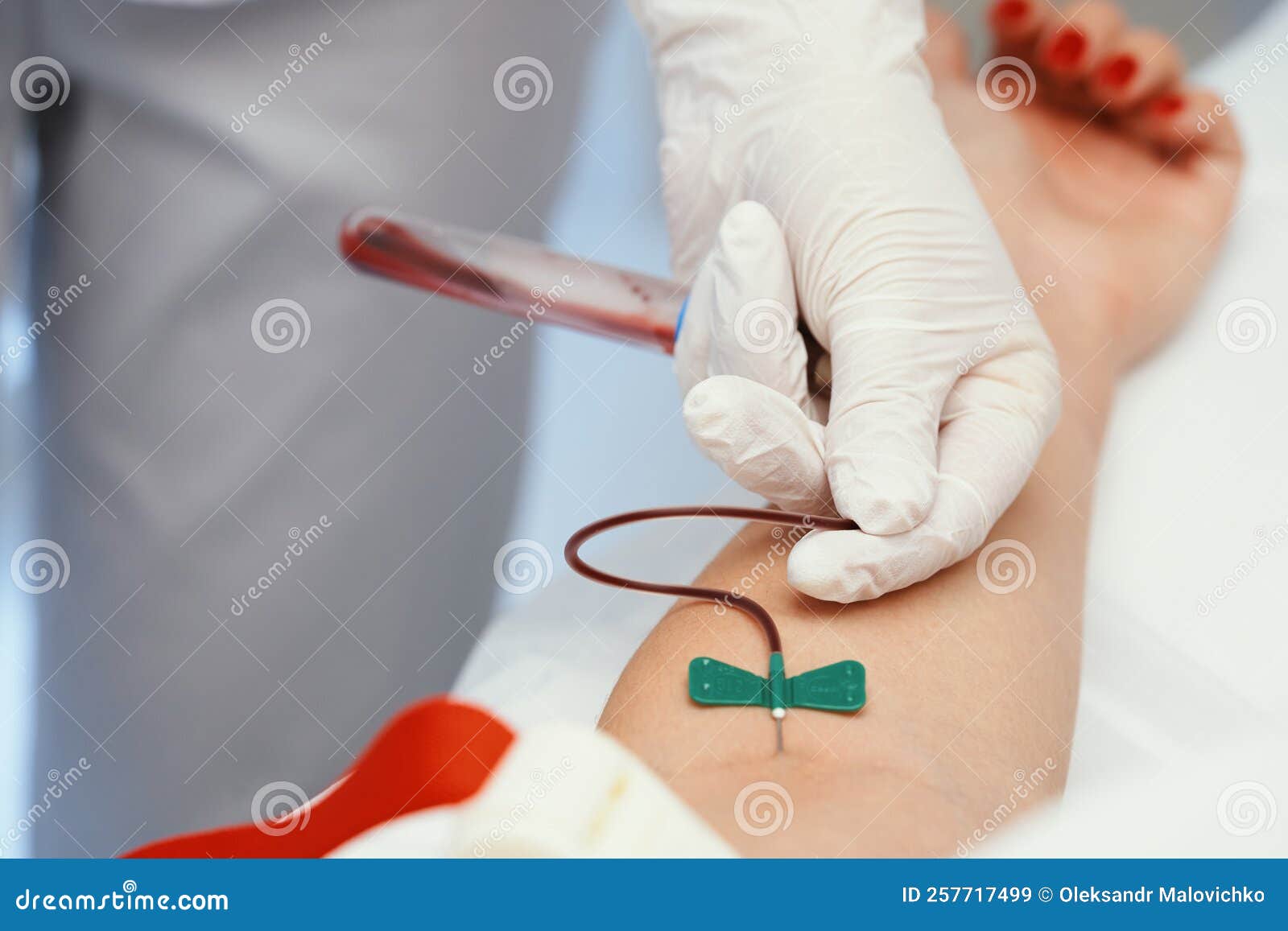 Arterial blood sampling. stock image. Image of medicine - 257717499