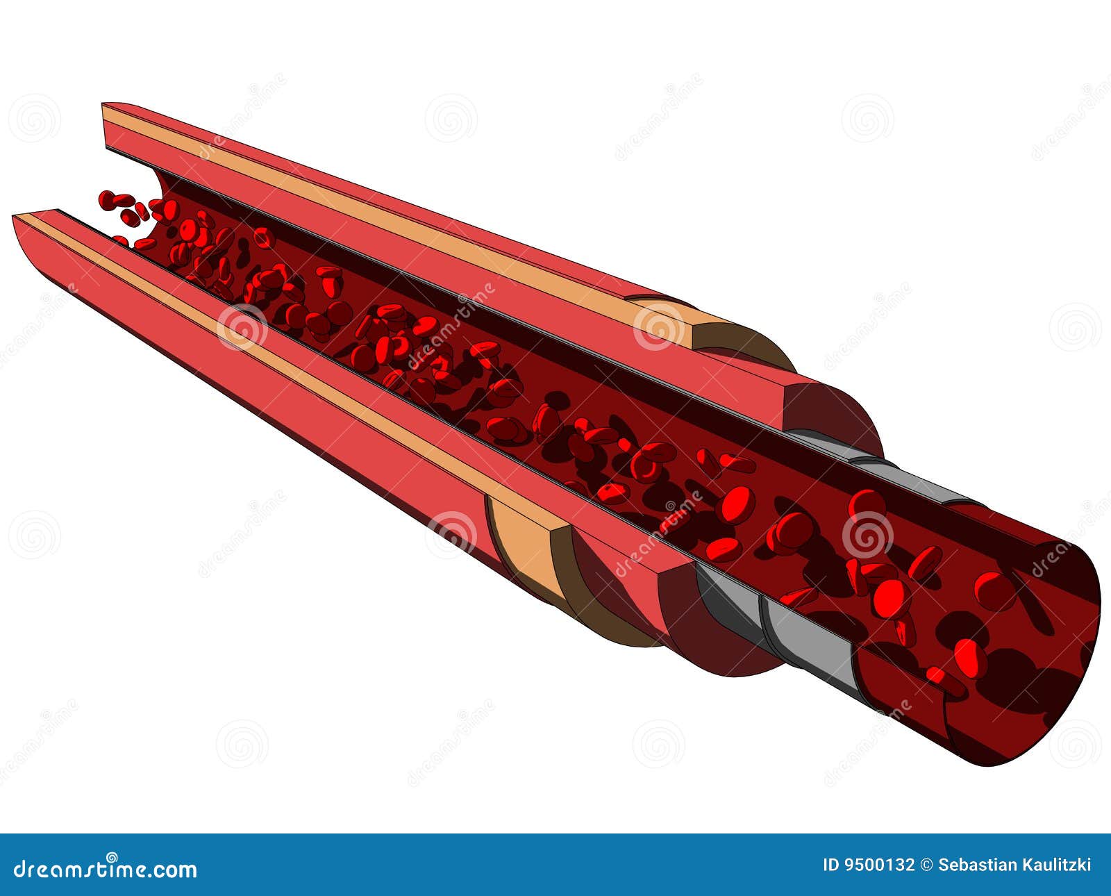Artery cut stock vector. Illustration of blood, biology - 9500132