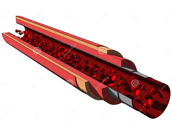 Artery cut stock vector. Illustration of blood, biology - 9500132