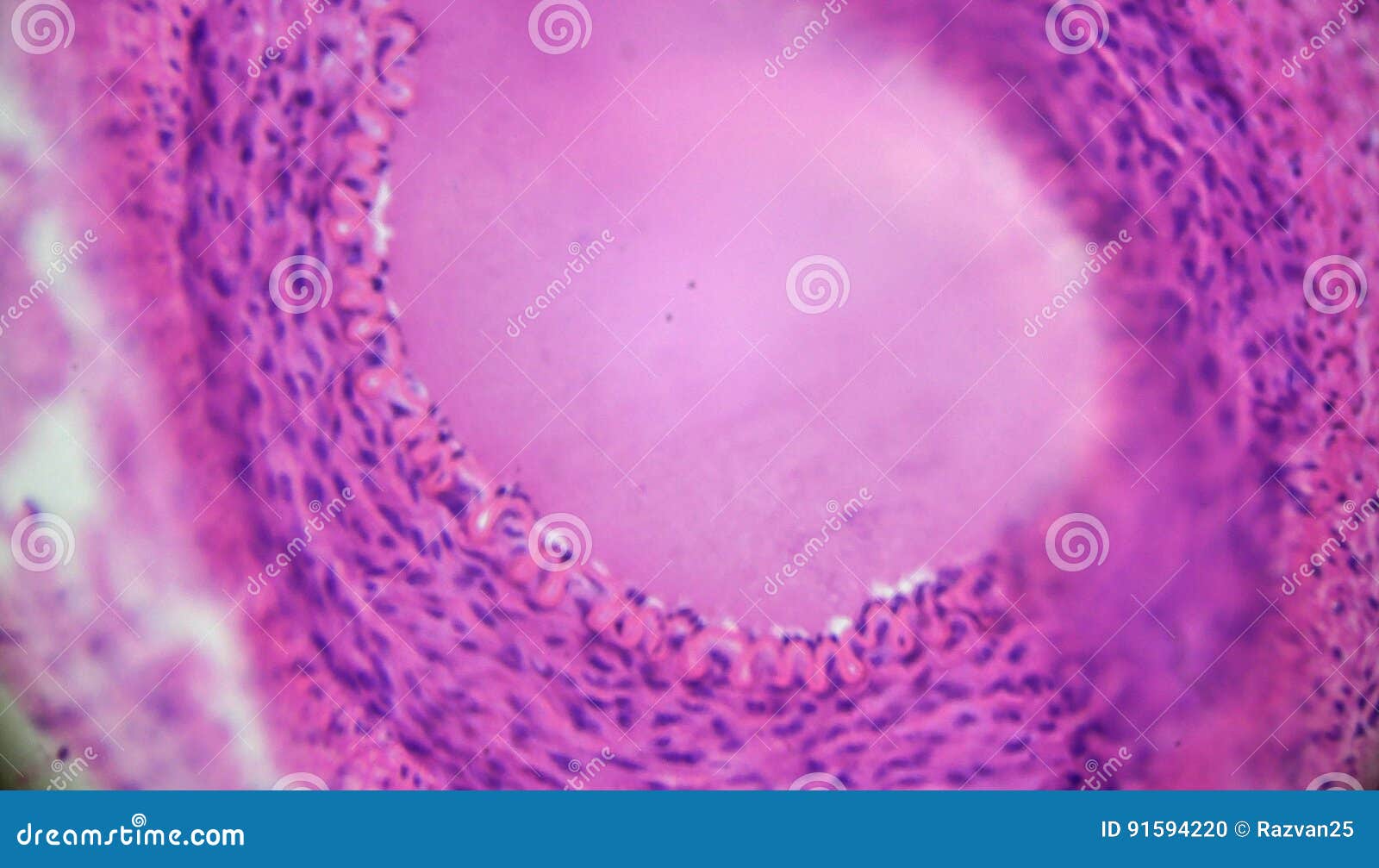 Artery Section Under the Microscope Stock Photo - Image of health ...
