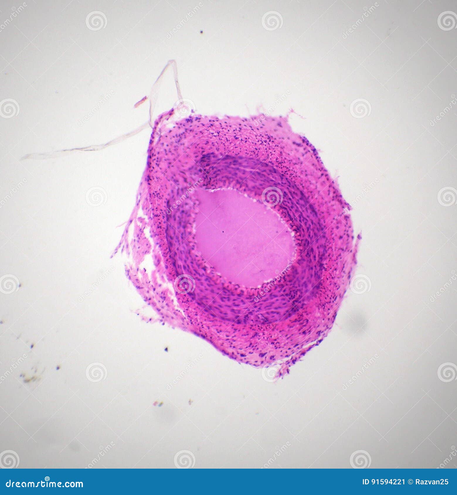 Artery Section Under the Microscope Stock Image - Image of organs ...