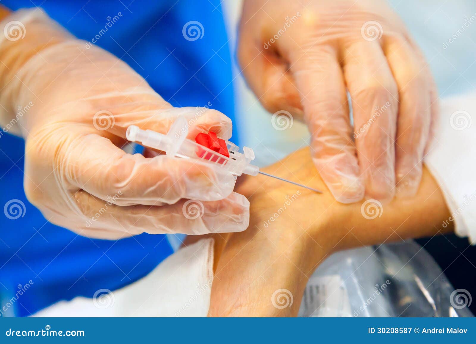 Artery (vein) Catheterization in Operation Room. Stock Image - Image of ...