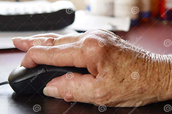 Arthritic Hand Using a Mouse Stock Photo - Image of hand, computer ...