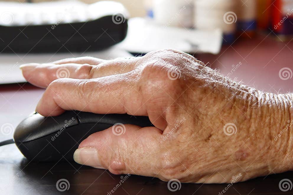 Arthritic Hand Using a Mouse Stock Photo - Image of hand, computer ...