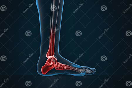 Arthritis of Ankle. X-ray of Foot Stock Illustration - Illustration of ...