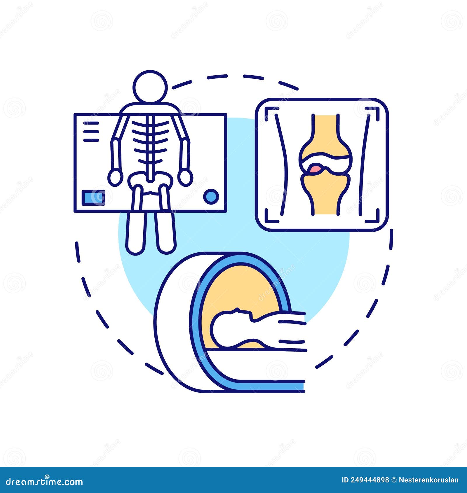 Arthritis. Disease Of Joints. Bones And Interosseous Cartilage Cartoon ...