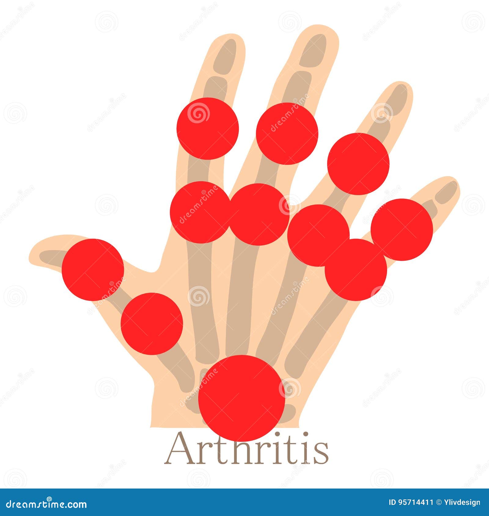 Arthritis Hand Icon, Cartoon Style Stock Vector - Illustration of cold ...