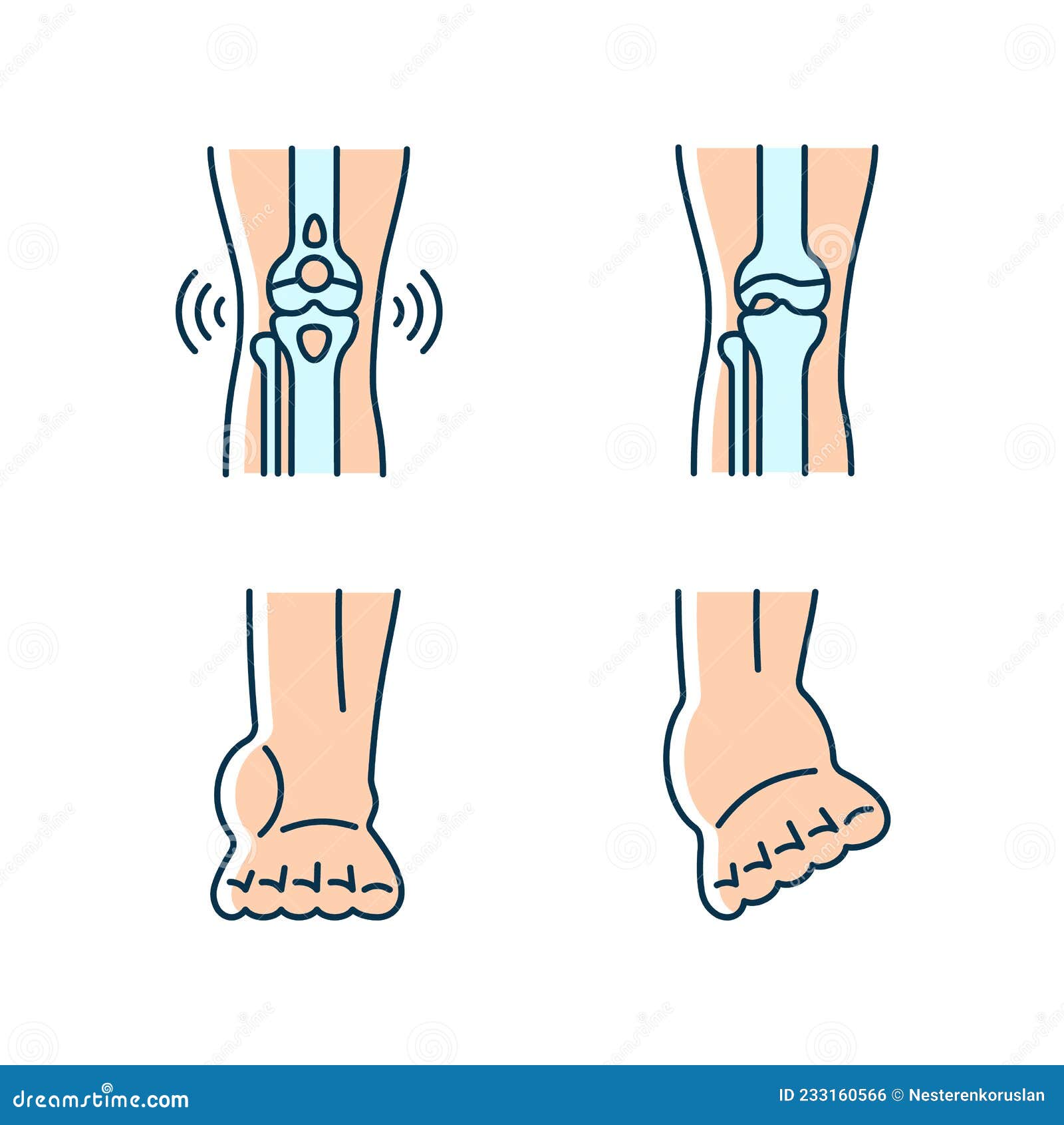 Arthritis Leg Pain RGB Color Icons Set Stock Vector - Illustration of ... Arthritis Leg Pain RGB Color Icons Set Stock Vector - Illustration of ...