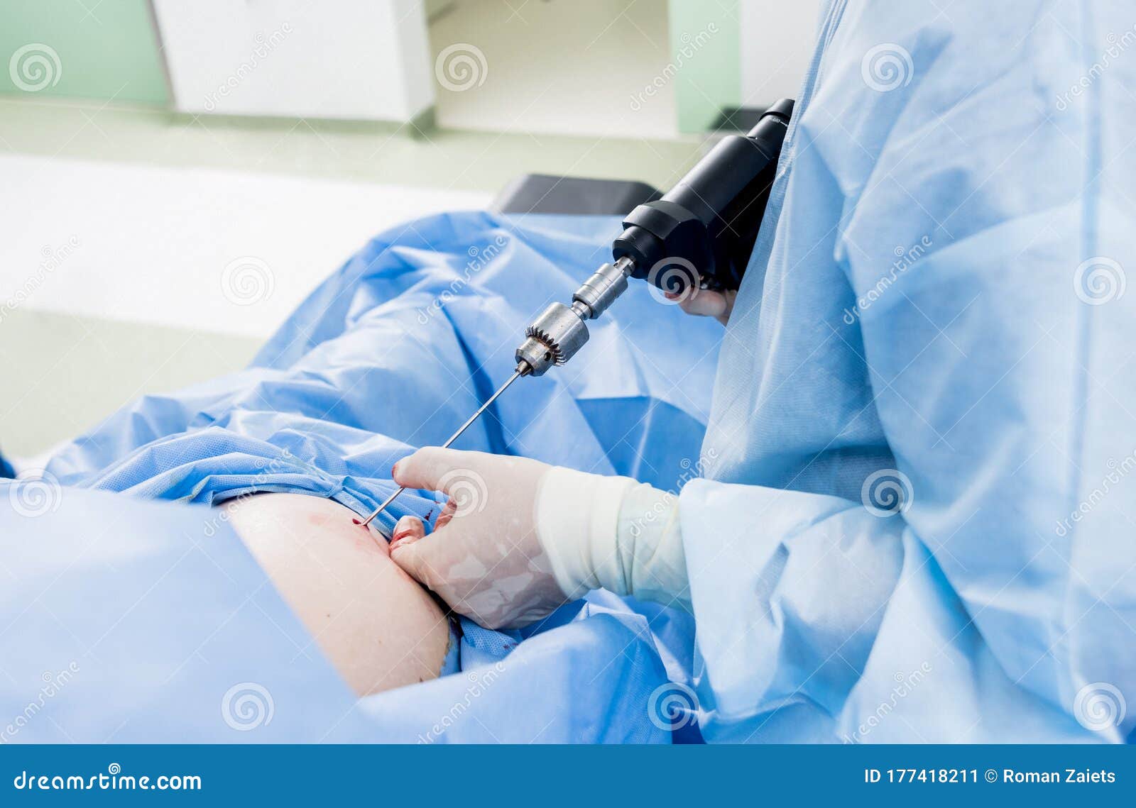 Arthroscope Surgery. Orthopedic Surgeons In Teamwork In The Operating ...