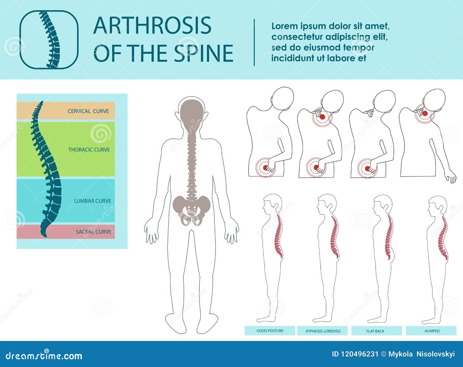 Spine Curves - Spinal Deformity. Symbol Of Spine Curvatures Or ...