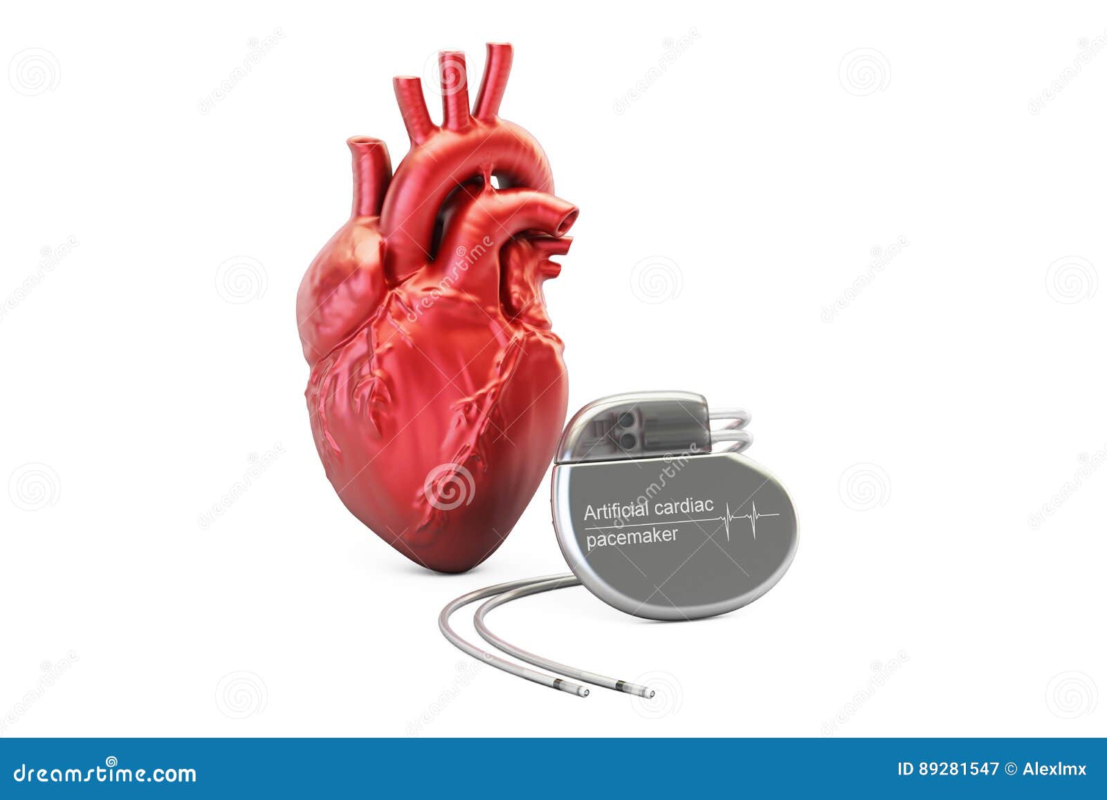 Artificial Cardiac Pacemaker, 3D Rendering Stock Illustration ...