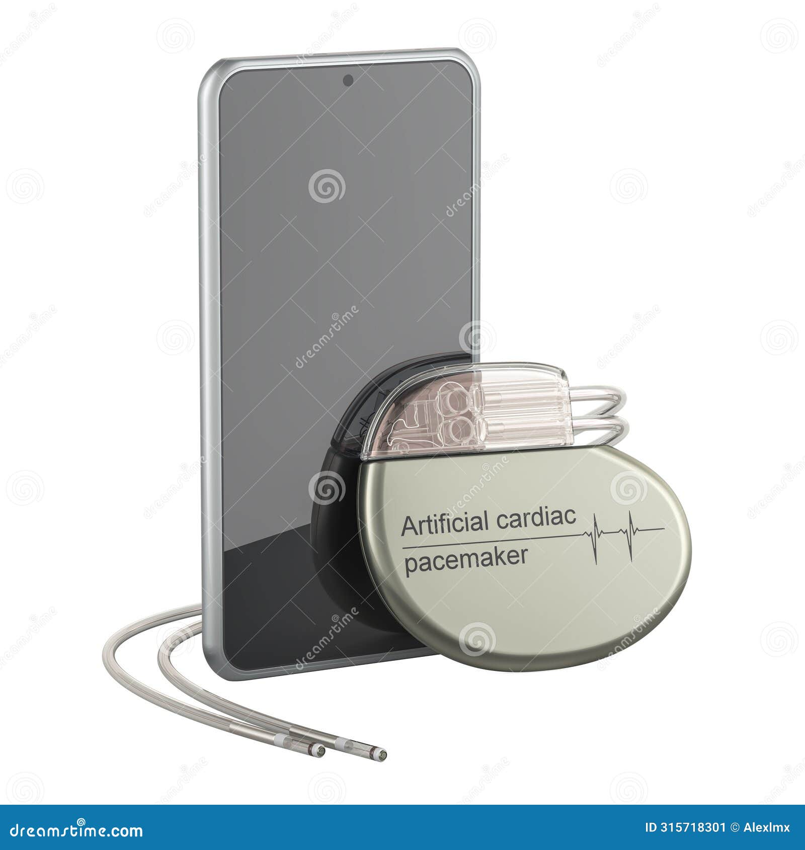 CT Cardiac 3D Rendering Or CTA Coronary Artery For Prevention Coronary ...