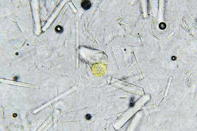 Artificial Honey with Large Rectangular Sugar Crystals Under Microscope ...