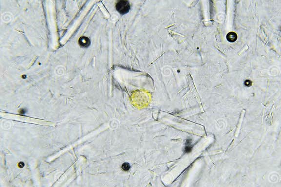 Artificial Honey with Large Rectangular Sugar Crystals Under Microscope ...
