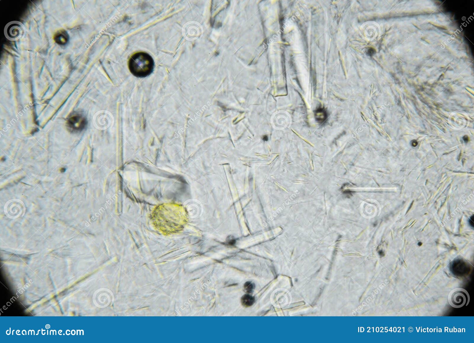 Artificial Honey with Large Rectangular Sugar Crystals Under Microscope ...