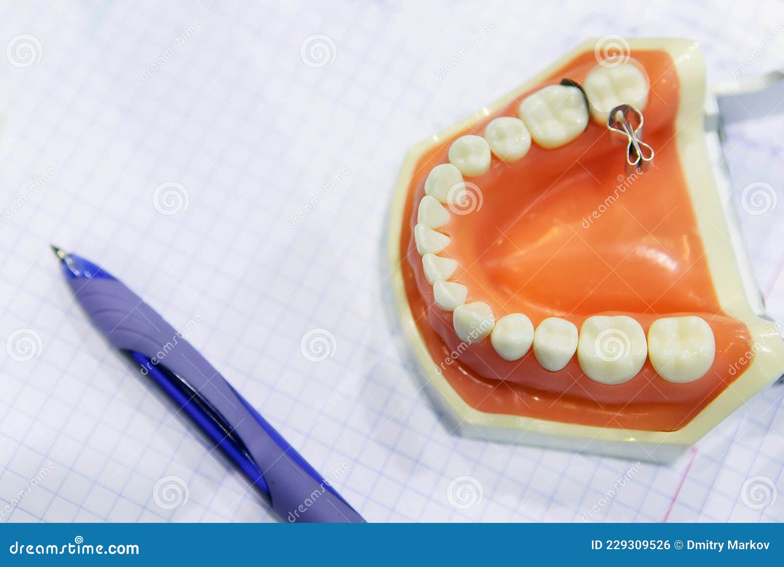 Artificial Human Jaw Prosthesis in a Dental Laboratory Stock Photo ...