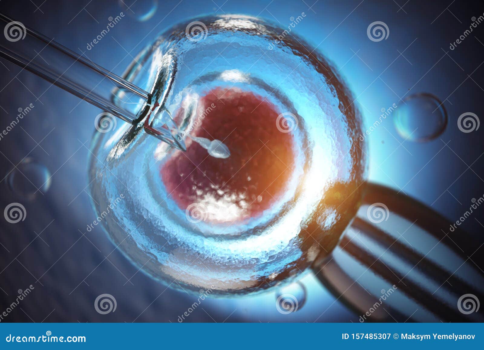 Artificial Insemination. Fertilization of Human Egg Cell by Sperm Stock ... Artificial Insemination. Fertilization of Human Egg Cell by Sperm Stock ...