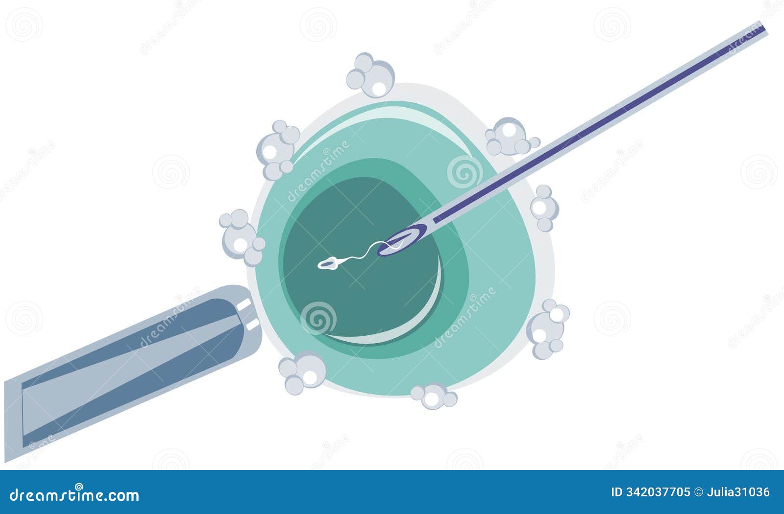 Artificial Insemination of Oocyte, Intracytoplasmic Injection, IVF-2 ...