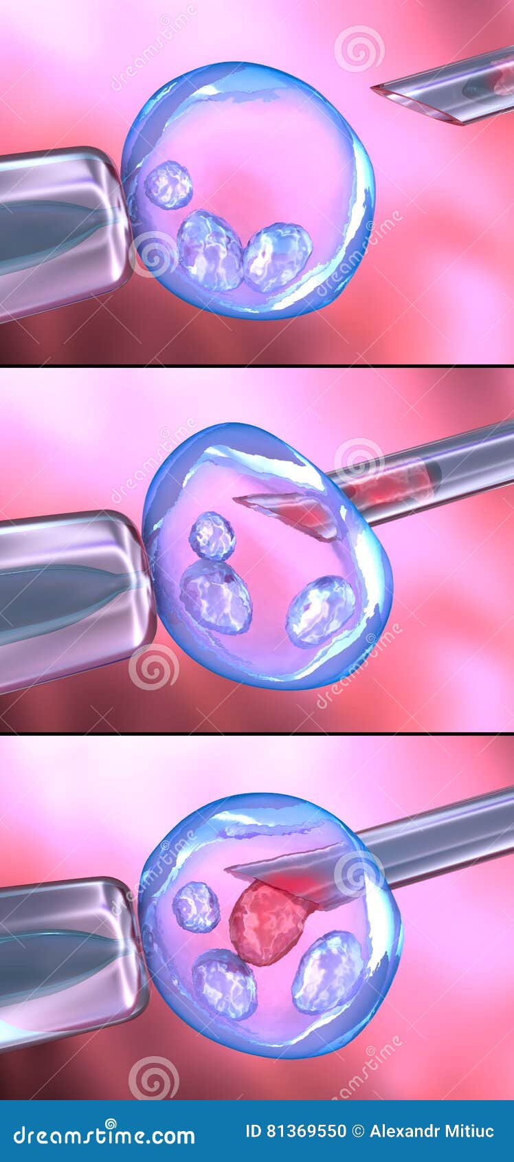 Artificial Insemination Process Stock Illustration - Illustration of ...