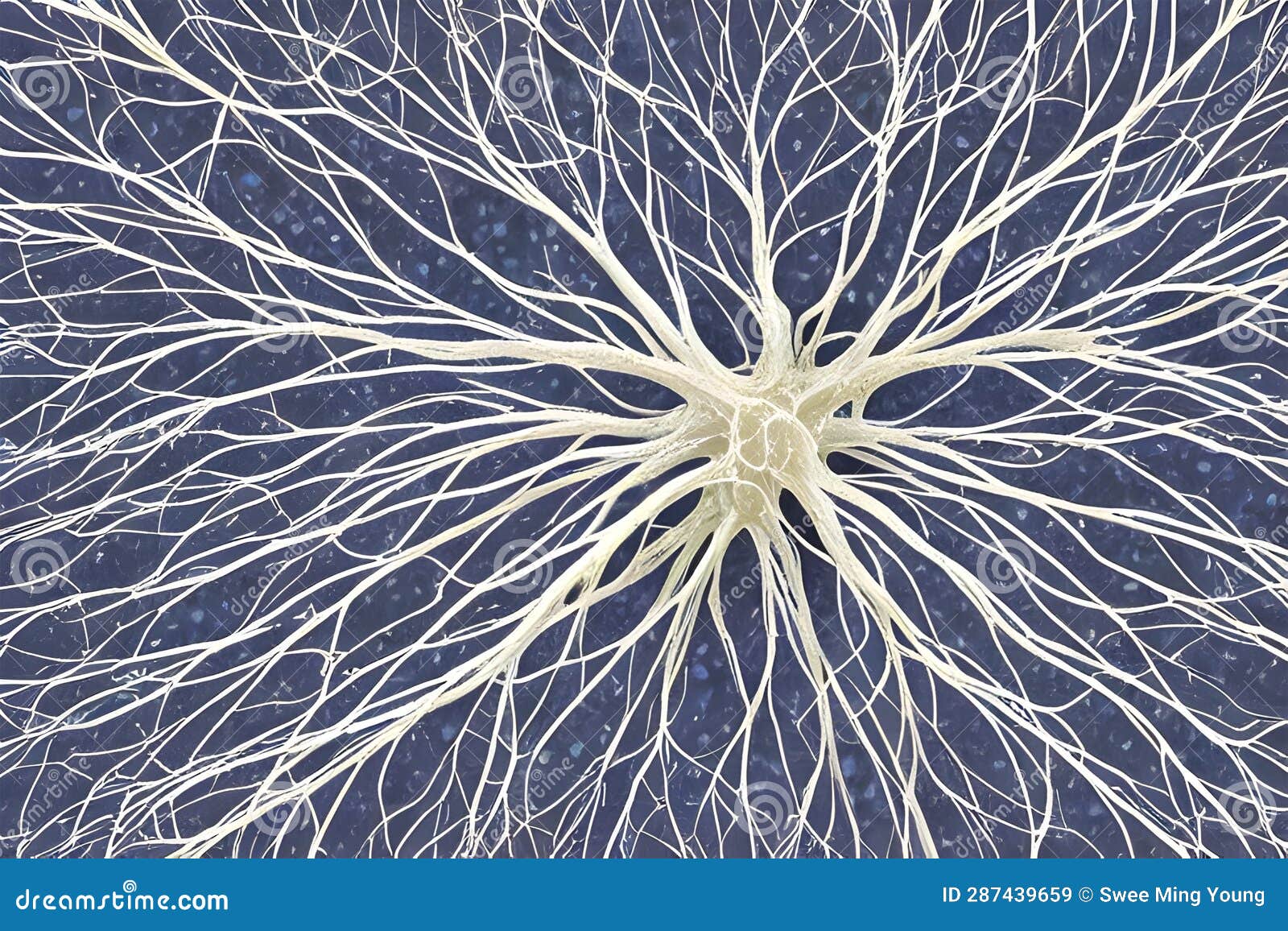 A Cluster of Neuron Floats and Branches Out with Axons and Dendrites of ...