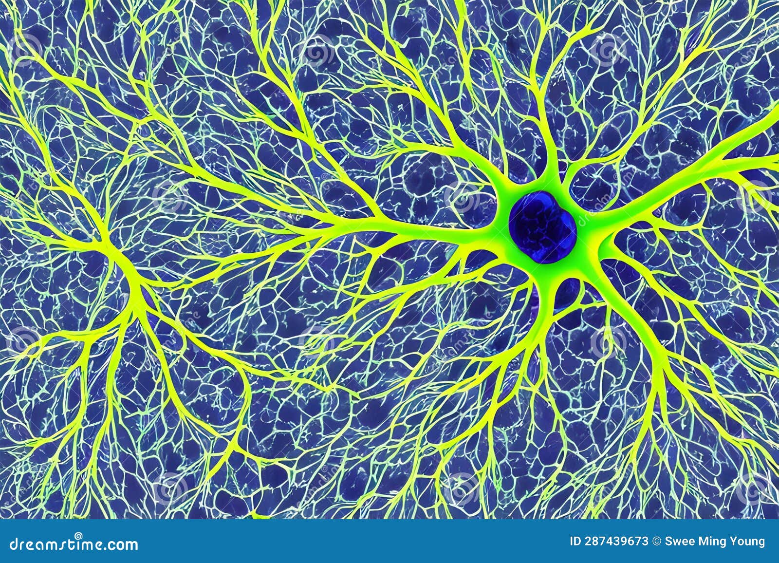 A Cluster of Neuron Floats and Branches Out with Axons and Dendrites of ...