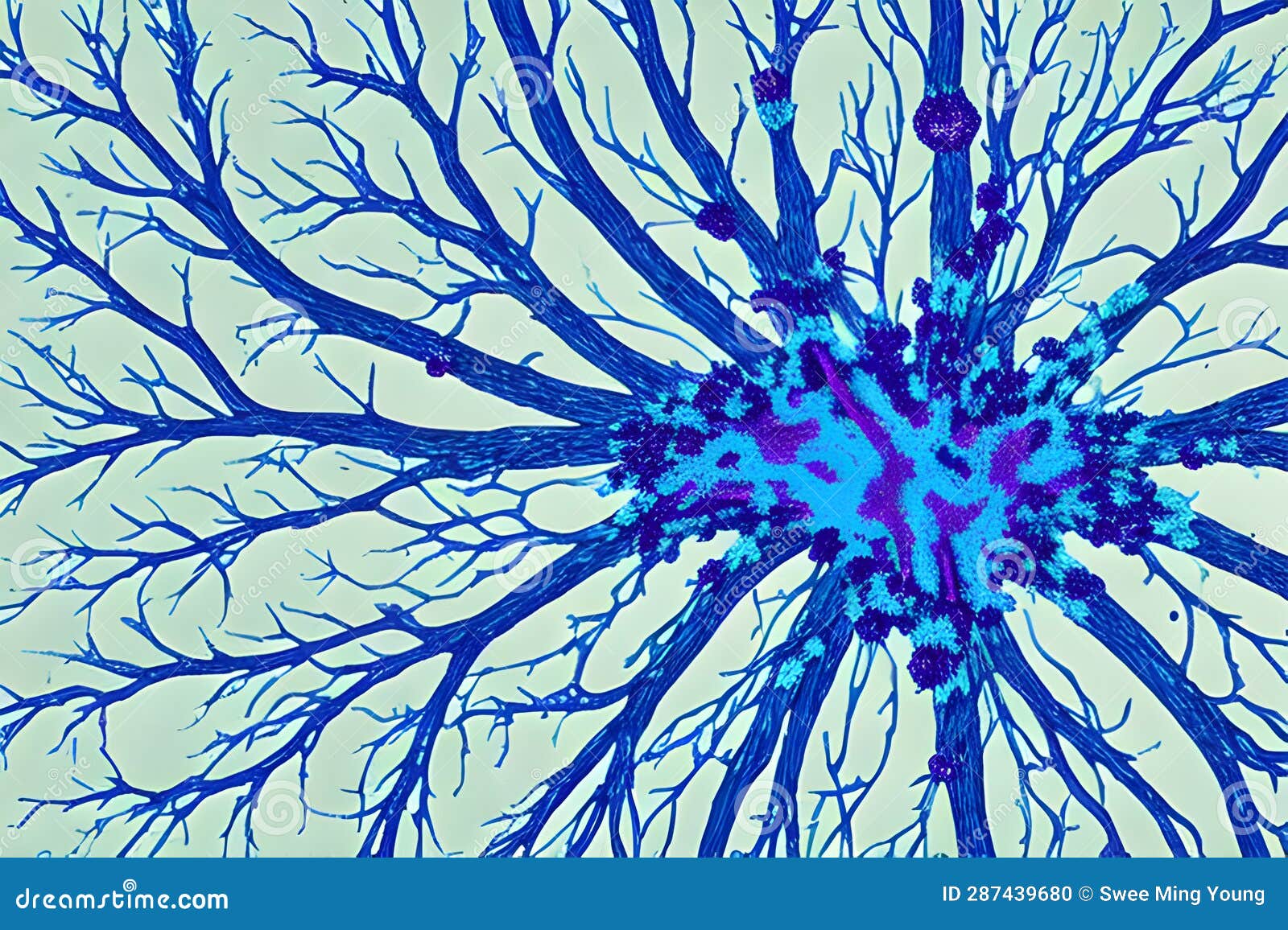 A Cluster of Neuron Floats and Branches Out with Axons and Dendrites of ...