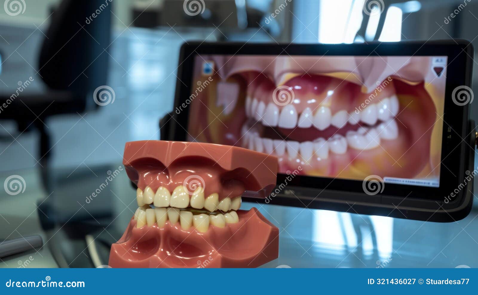 Dental Model with Digital Display Stock Image - Image of healthcare ...
