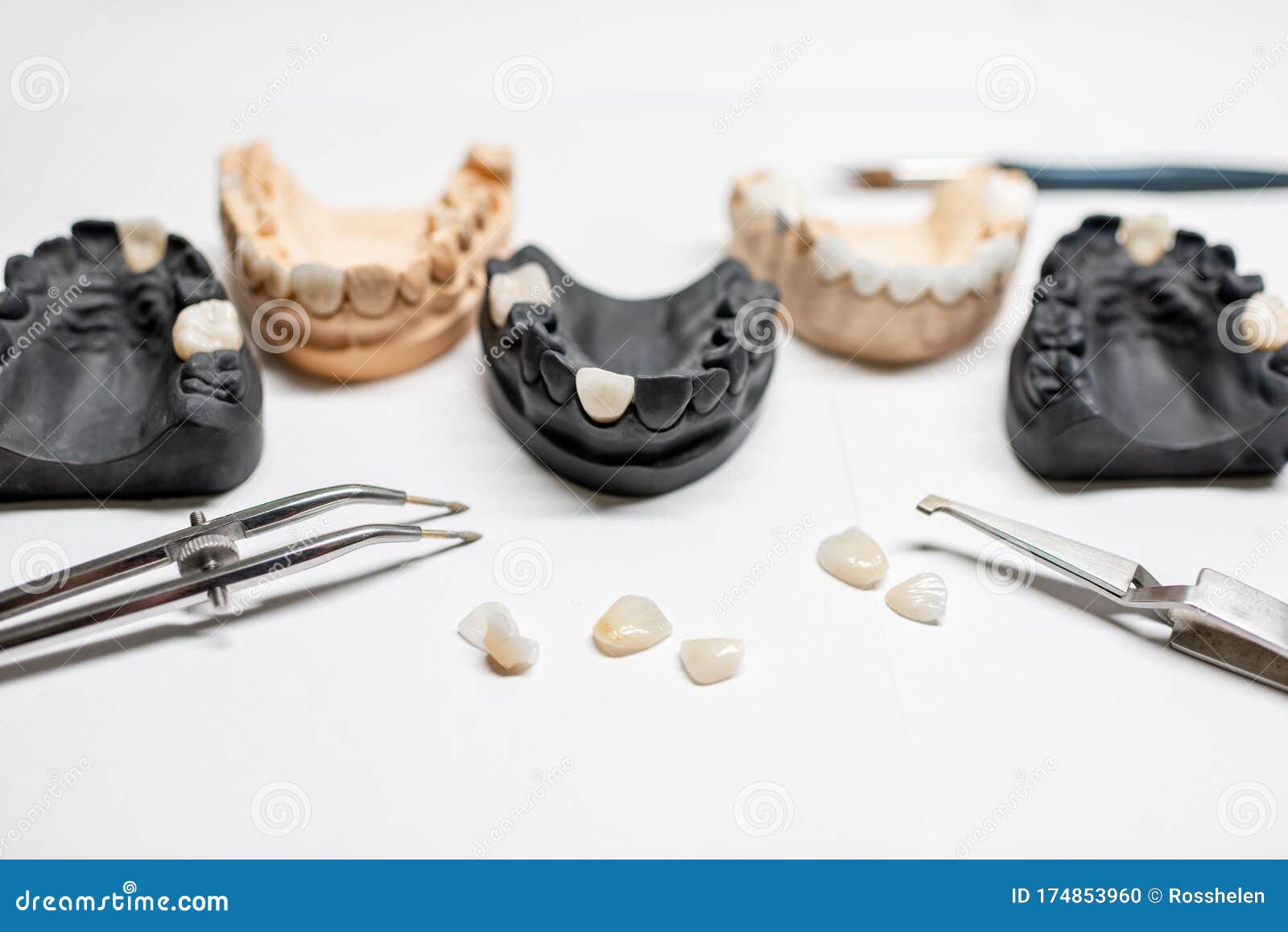 Artificial Jaw Models with Veneers Stock Photo - Image of instrument ...