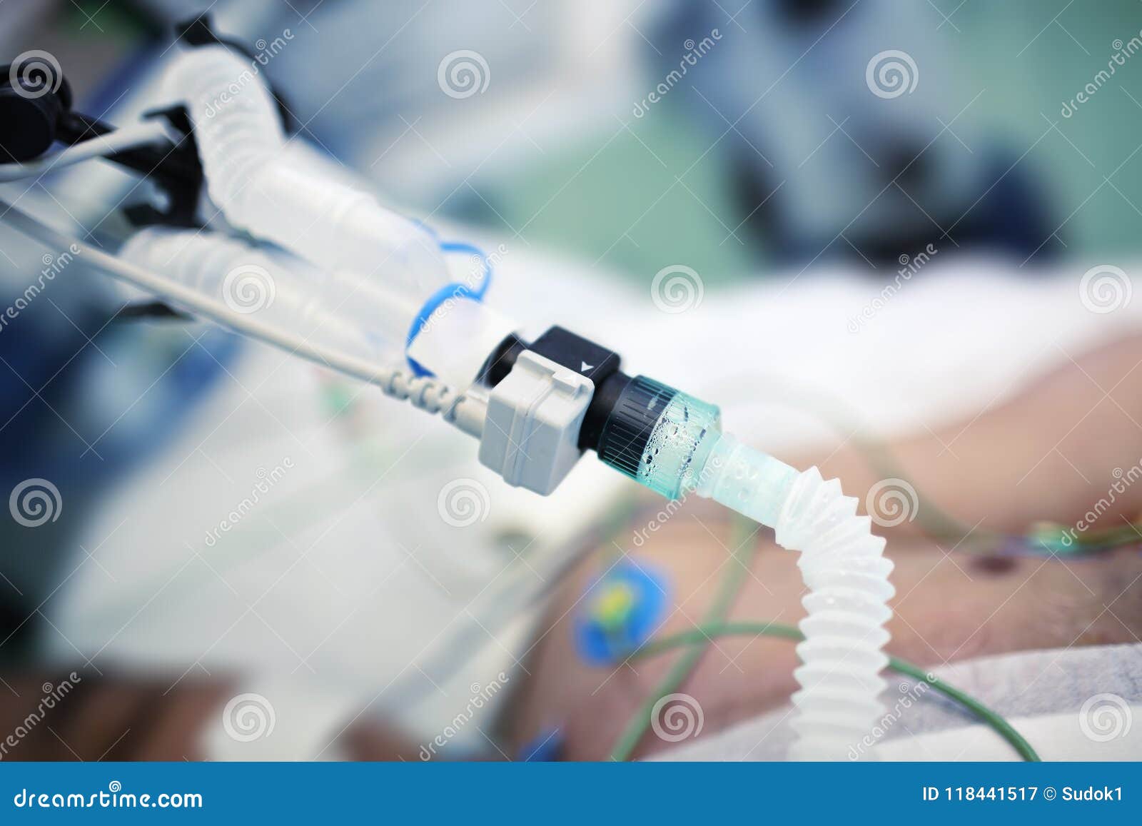 Artificial Lung Ventilation Tube Connected To the Patient in the Stock ...