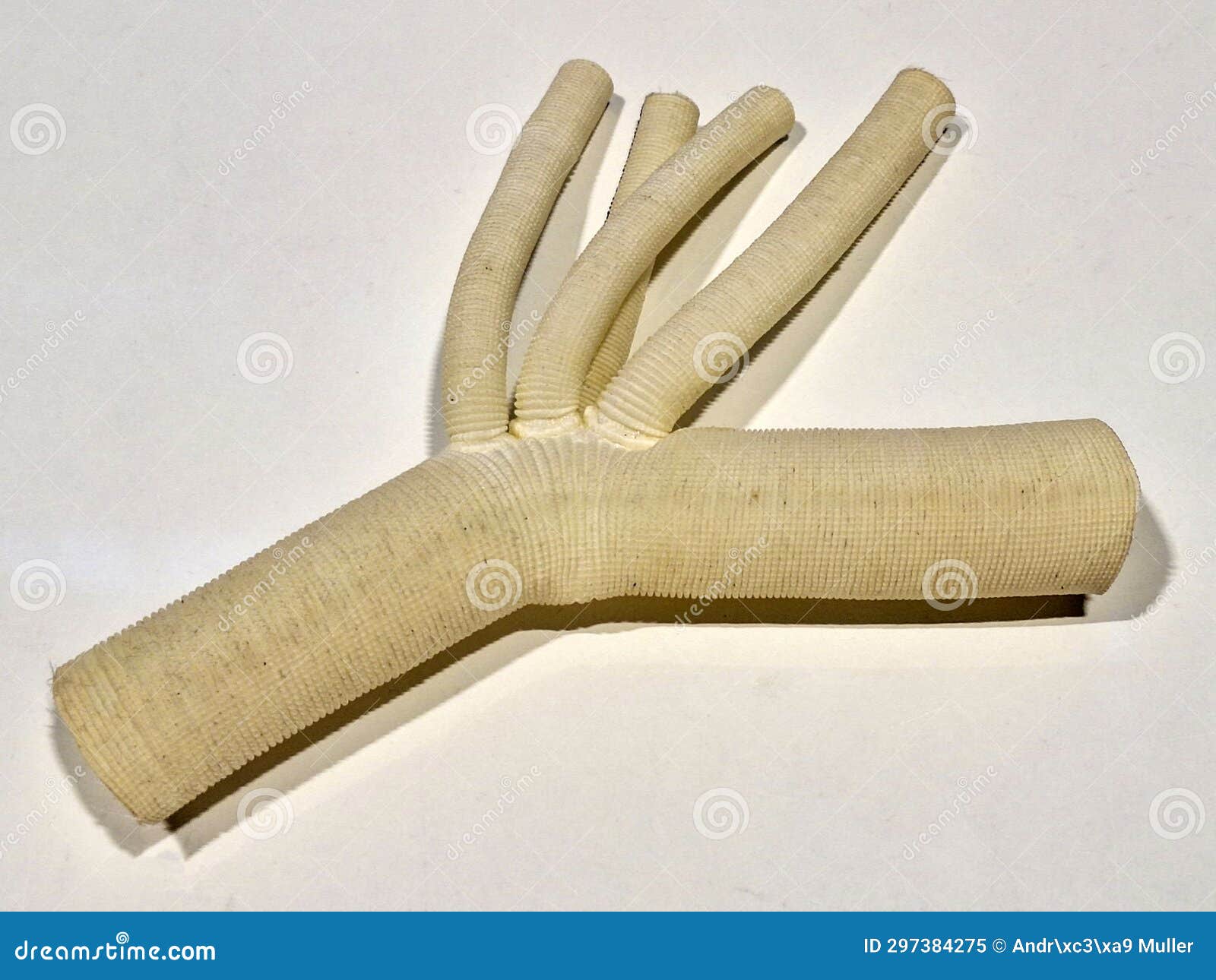 Artificial Prosthesis for the Aortic Arch for Replacement in Cases Such ...