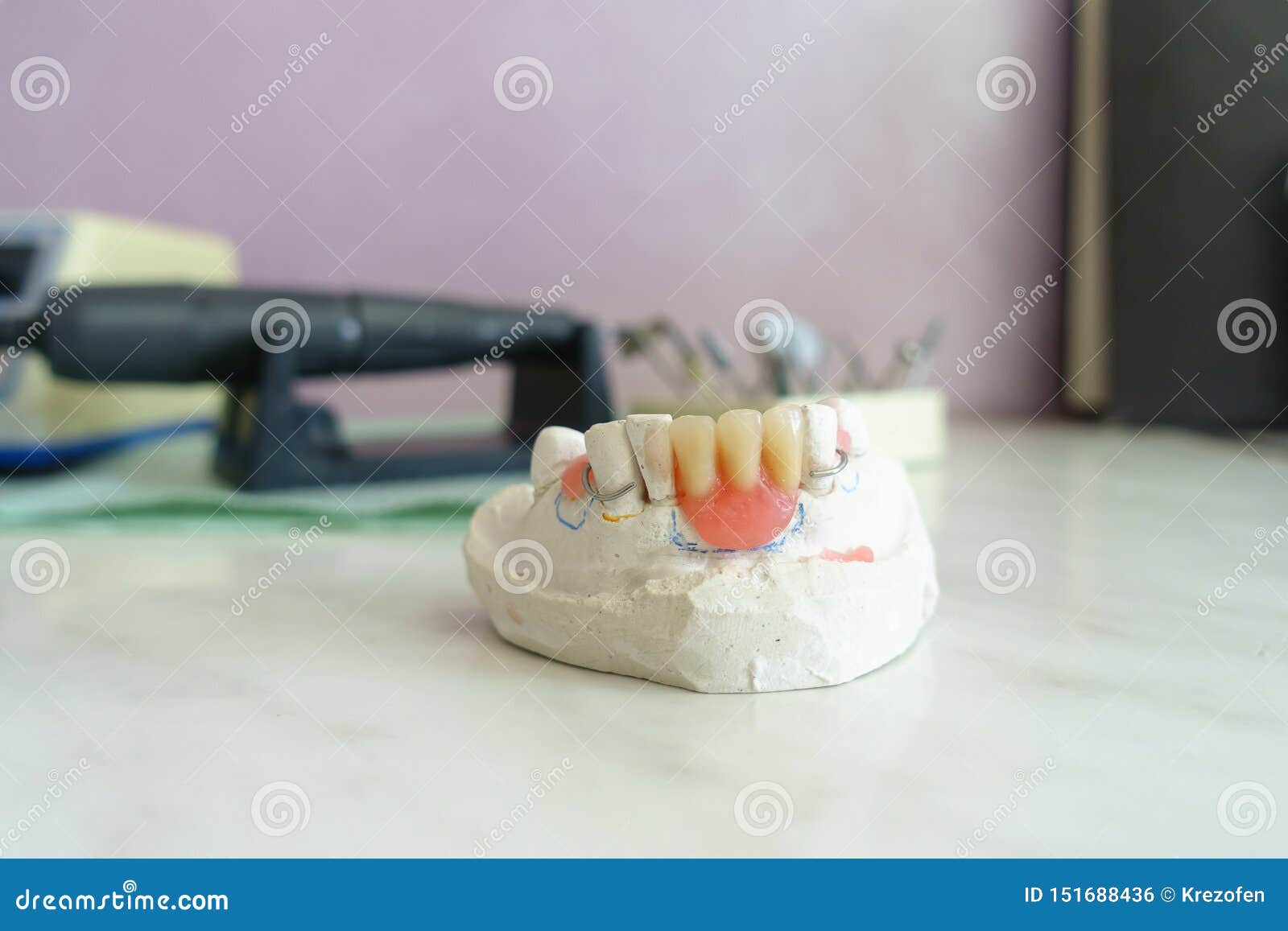 Artificial Removable Partial Denture. Royalty-Free Stock Photo ...