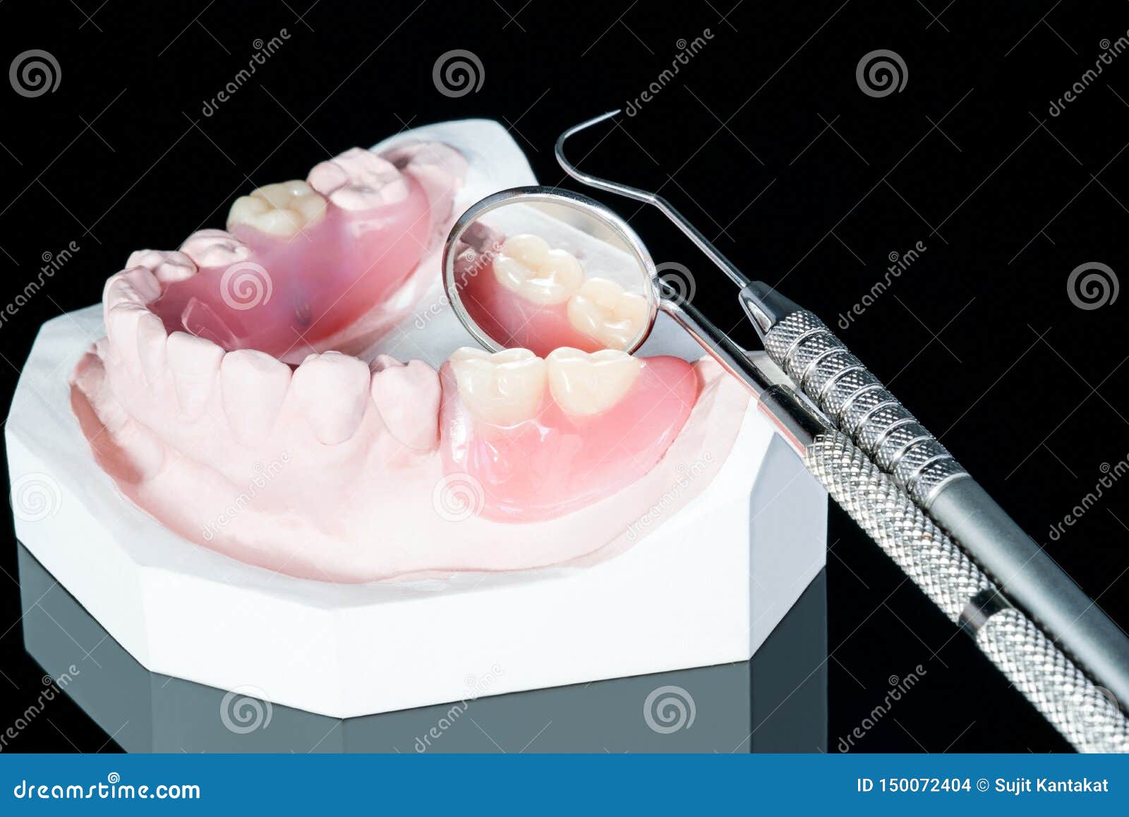 Artificial Removable Partial Denture. Stock Photo - Image of closeup ...