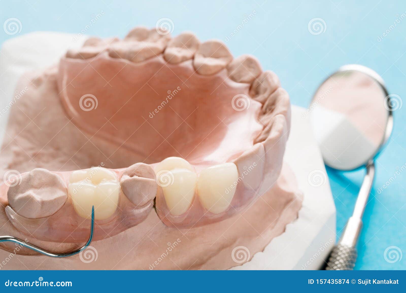 Artificial Removable Partial Denture. Royalty-Free Stock Photo ...