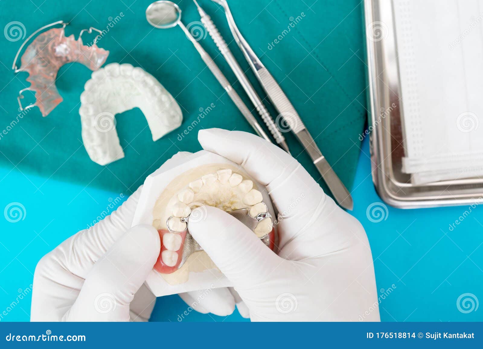Artificial Removable Partial Denture. Stock Photo - Image of dentistry ...
