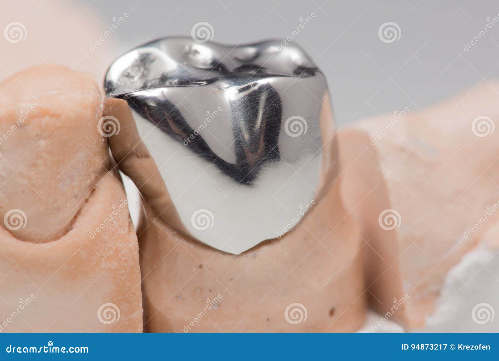 Artificial tooth crown stock image. Image of health, orthodontist ...