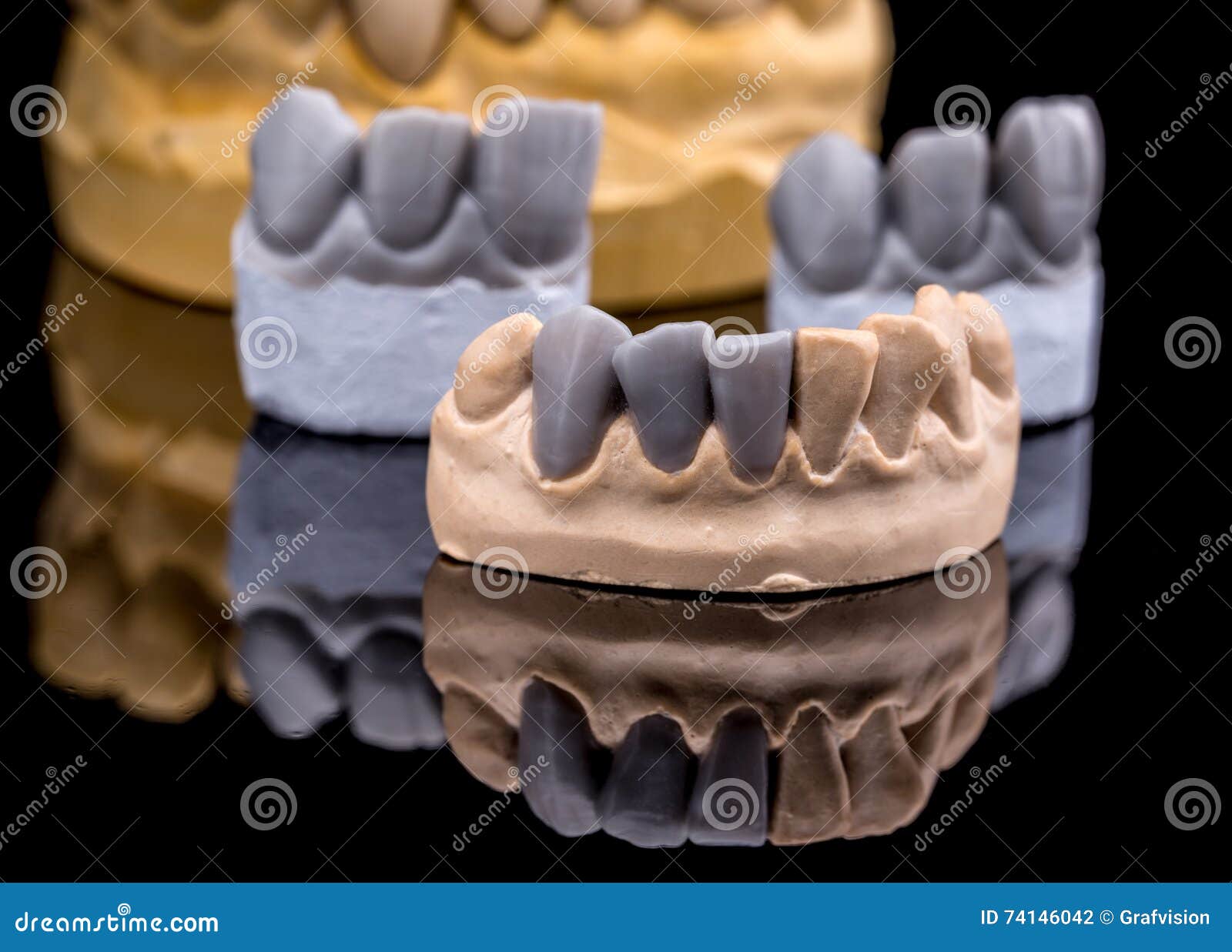 Artificial Tooth, Dental Prosthesis With False Silver Tooth, Metalic ...