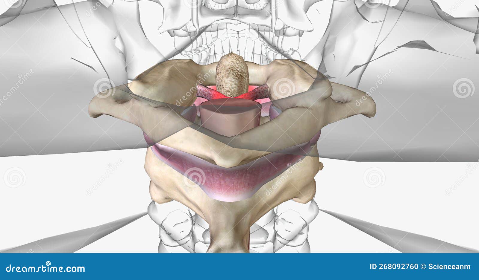 Artrite Reumatoide Nella Colonna Cervicale Illustrazione di Stock ...