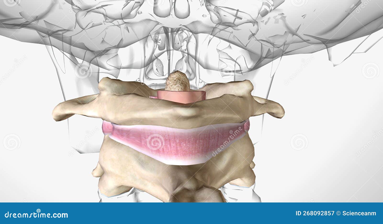 Artrite Reumatoide Nella Colonna Cervicale Illustrazione di Stock ...