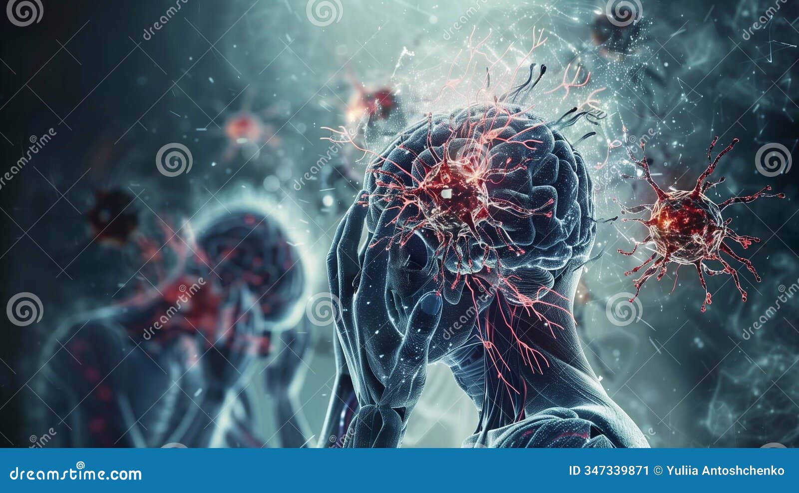 This Artwork Shows How Encephalitis Affects the Brain, Highlighting ...