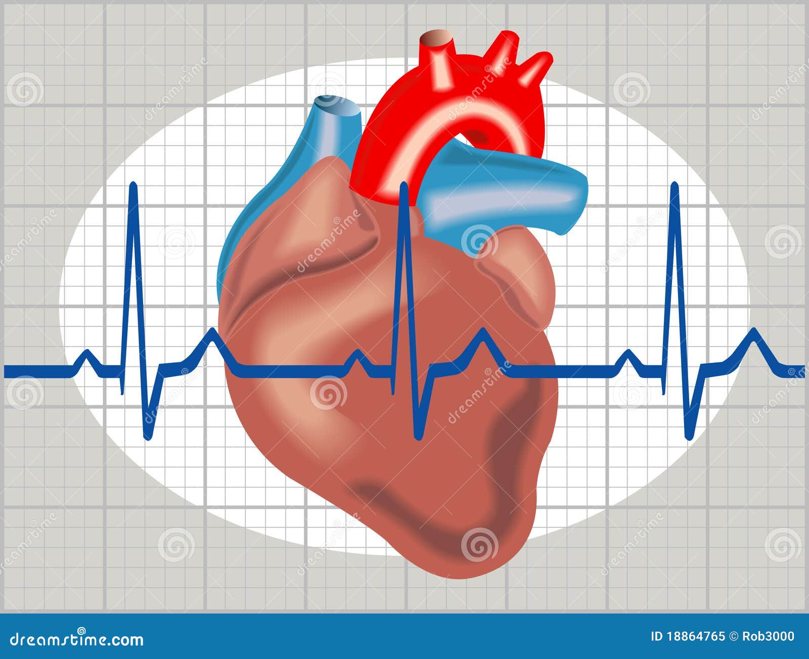 Arythmie cardiaque illustration de vecteur. Illustration du tachycardie ...