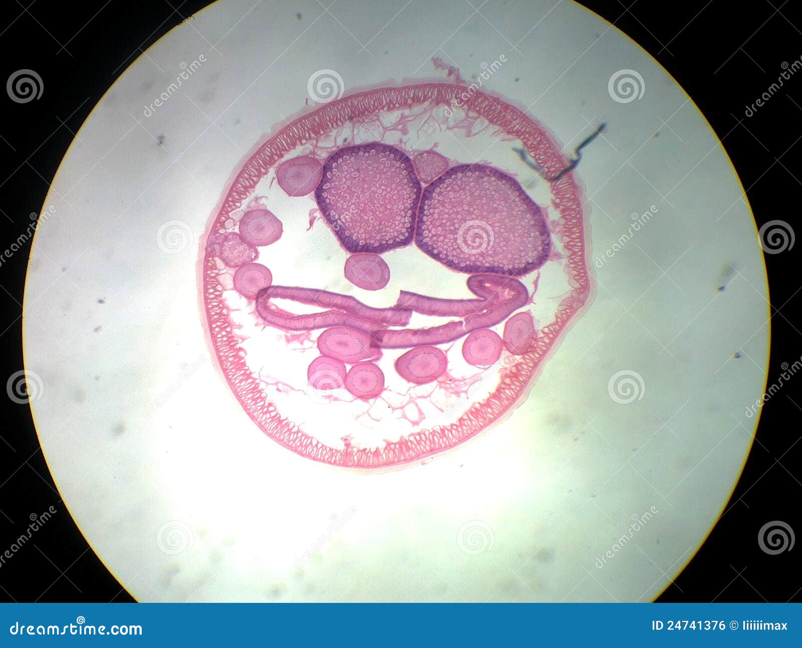 🏆 Ts of male ascaris. Ascaris: Habitat, Nervous System and Life History ...