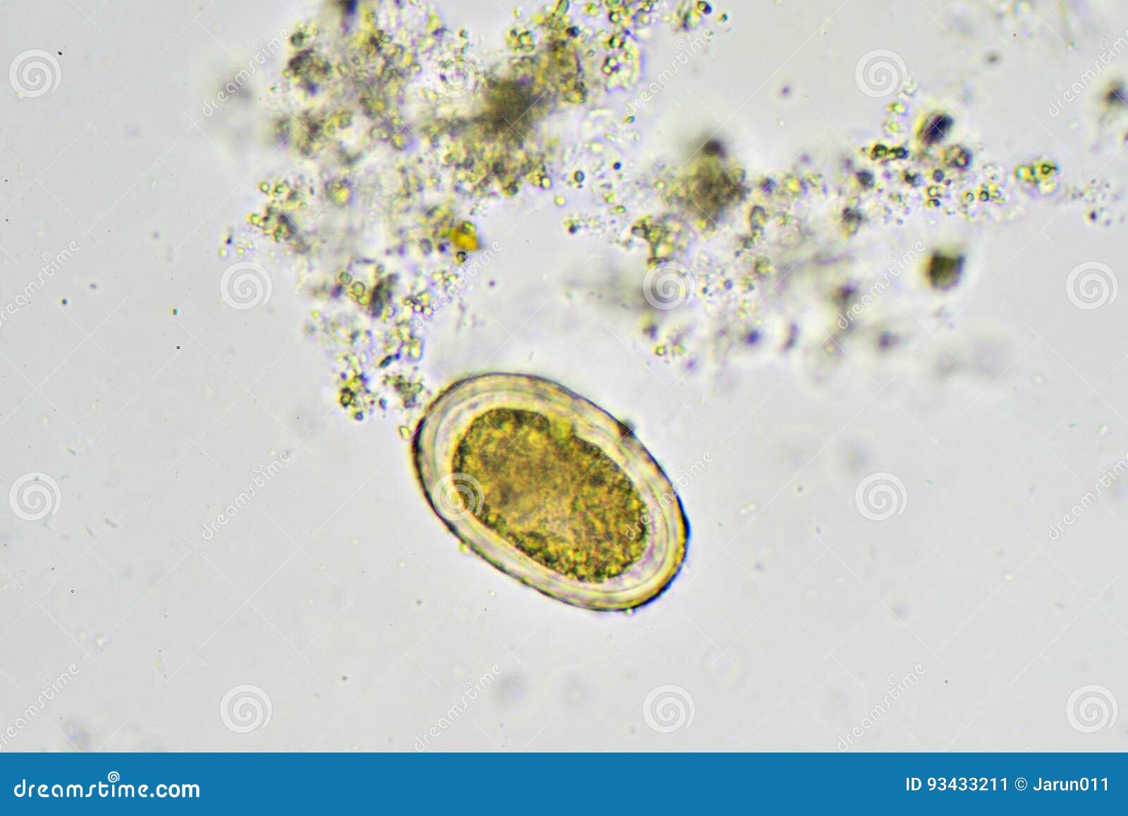 Ascaris lumbricoides stock image. Image of medical, cestode - 93433211