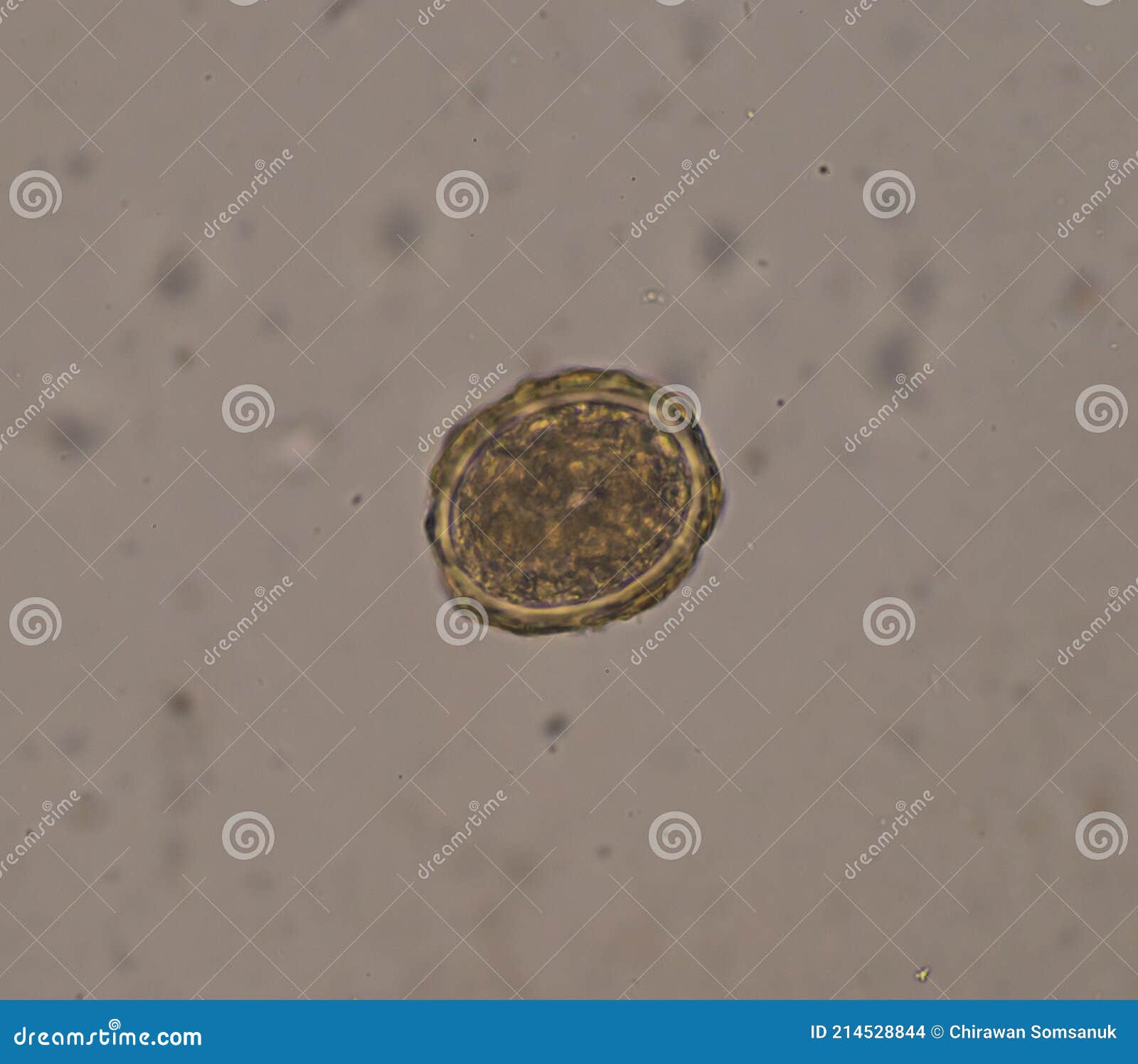 Ascaris Eggs In Stool