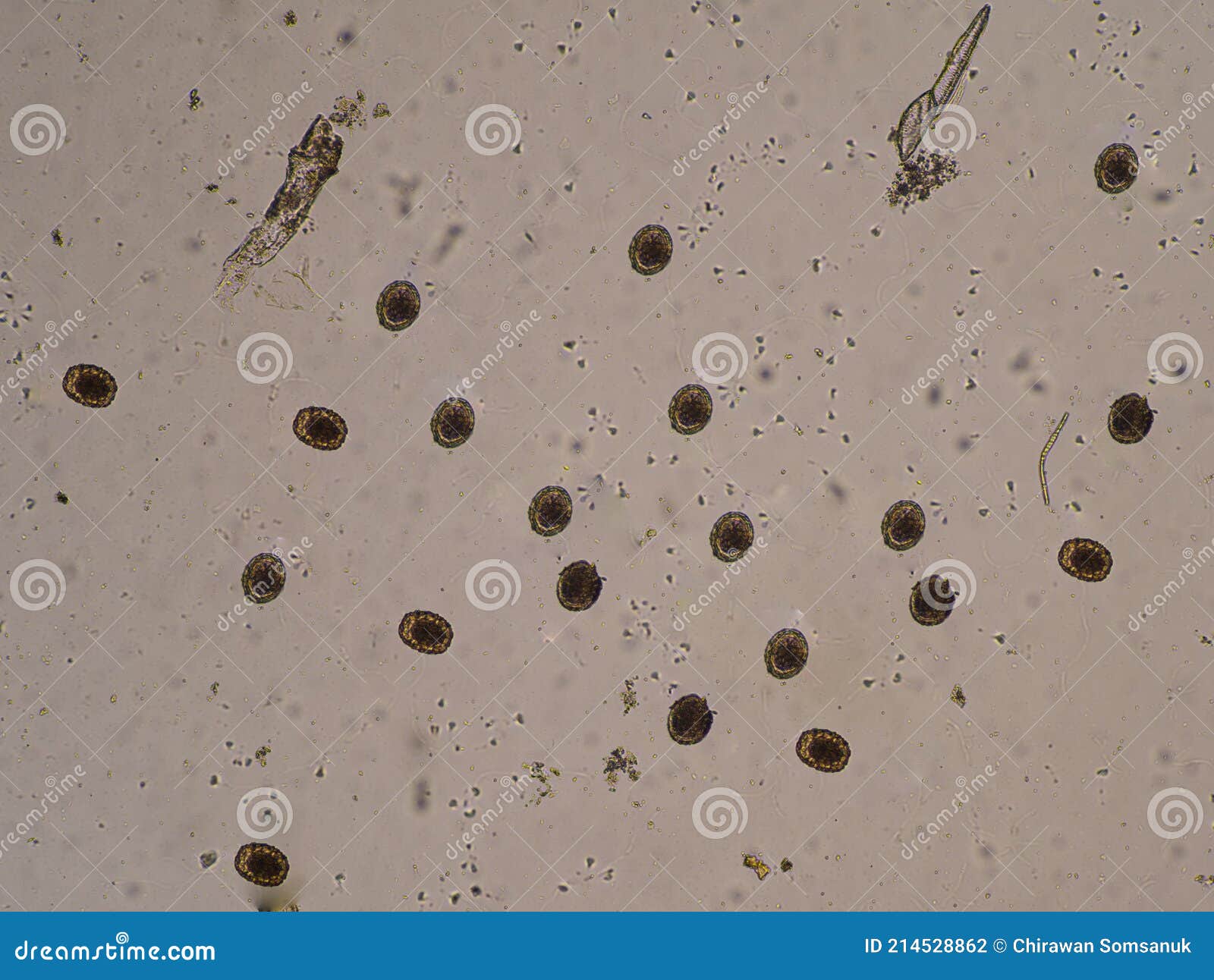 Ascaris Lumbricoides Egg in Stool Exam Stock Photo - Image of ...