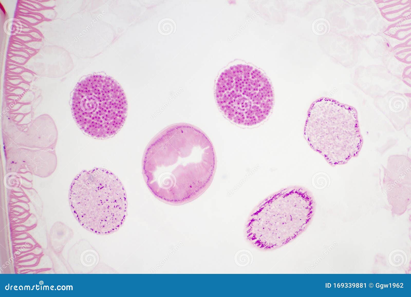 Ascaris lumbricoides stock image. Image of experiment - 169339881
