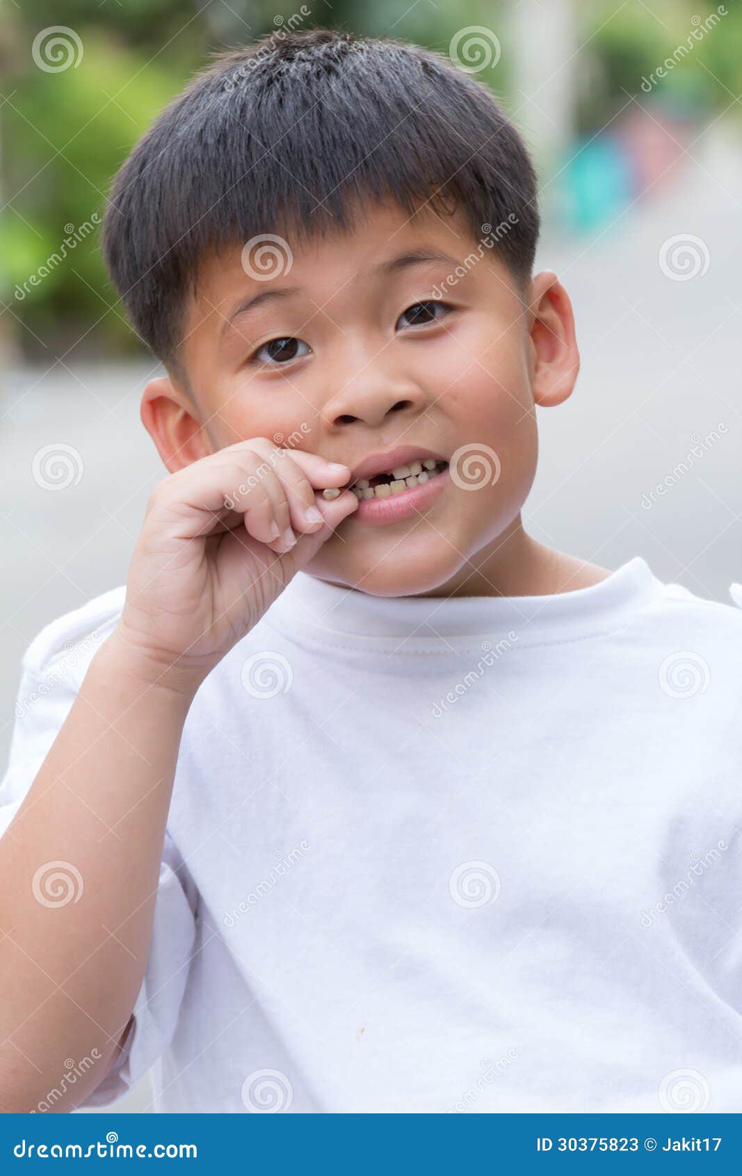 Asian boy broken tooth stock image. Image of person, closeup - 30375823
