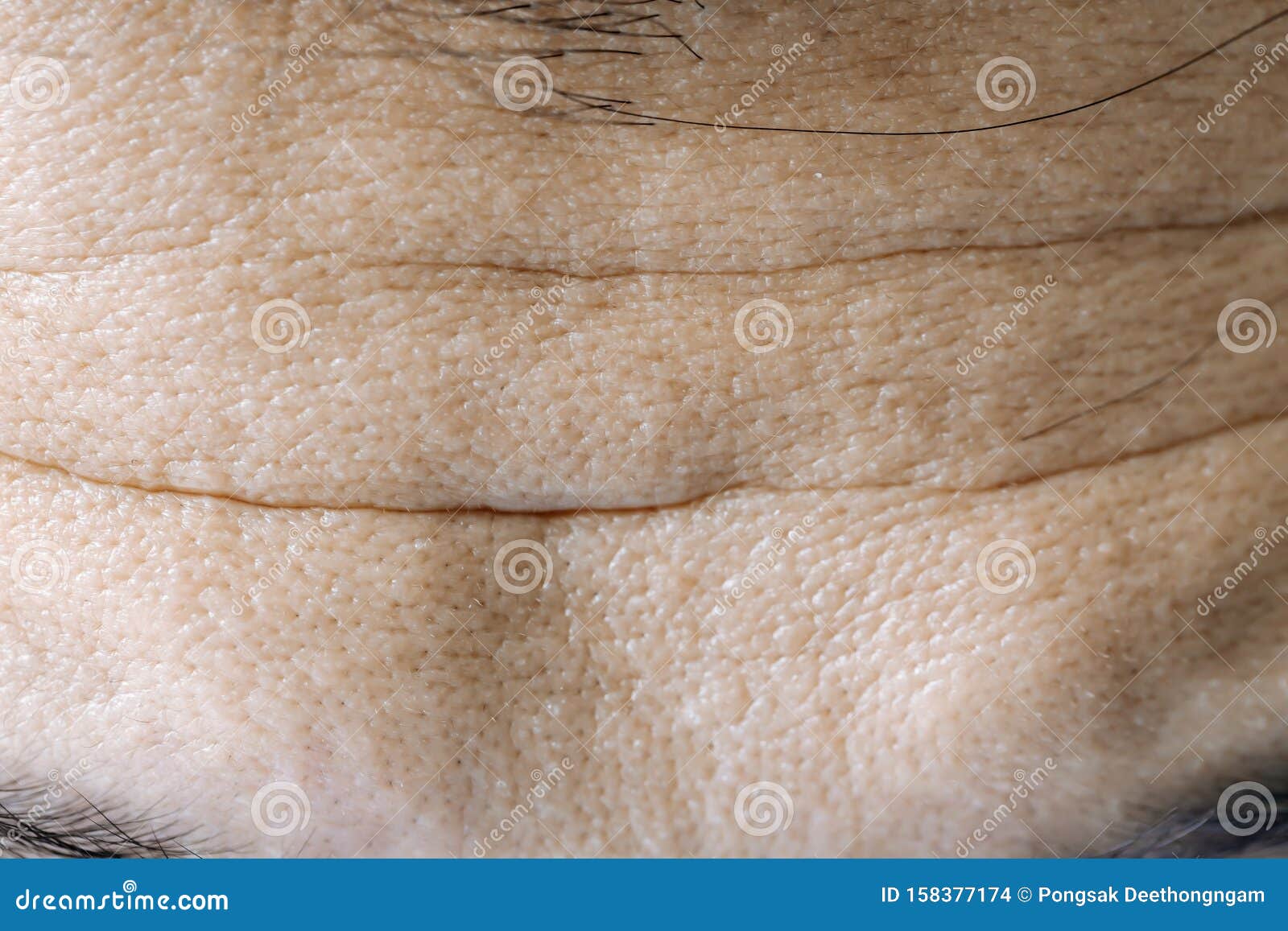 Asian Face Skin Problems stock photo. Image of beautiful - 158377174